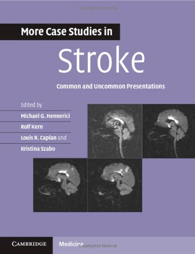 More Case Studies in Stroke: Common and Uncommon Presentations ...