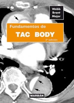 Amazon.com: FUNDAMENTOS DE TAC BODY BOLSILLO: 9788471015730: WEBB: Libros