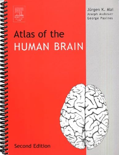 Atlas of the Human Brain, Second Edition: 9780124657410: Medicine ...