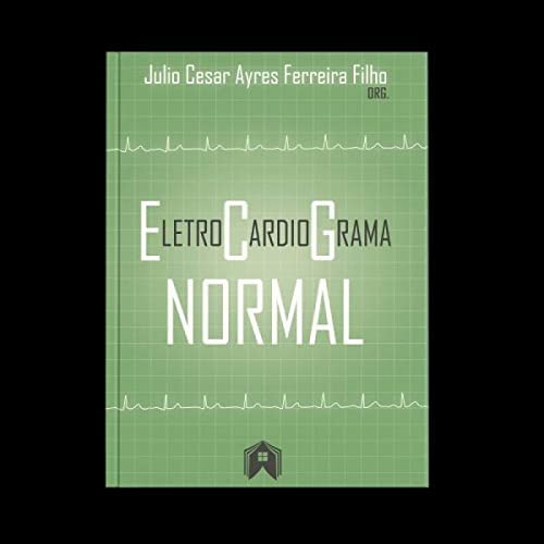 Eletrocardiograma Normal | Amazon.com.br