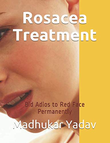 Rosacea Treatment: Bid Adios to Red Face Permanently: Yadav, Madhukar ...
