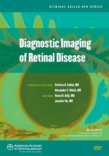 Diagnostic Imaging of Retinal Disease DVD: Sadda, Srinivas R ...