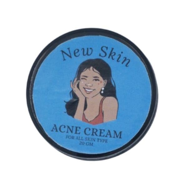 Anti Acne Pimple Removal Cream for Women & Girls | Anti Pimples & Acne ...