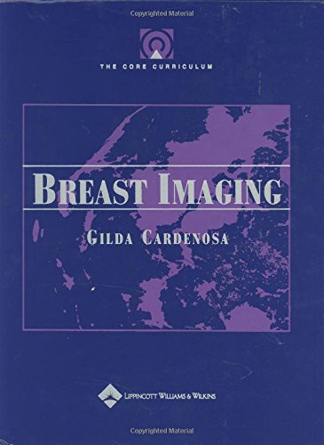 Breast Imaging (The Core Curriculum Series): 9780781746854: Medicine ...