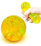 Amazon.com: Squishy Stress Balls (2 Pack) Spiky Stress Ball Squishy ...