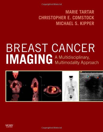 Breast Cancer Imaging: A Multidisciplinary, Multimodality Approach ...