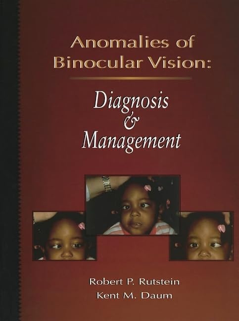 Anomalies Of Binocular Vision: Diagnosis And Management: 9780801669163 ...