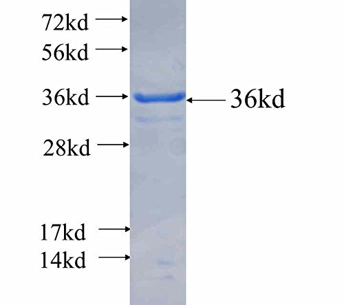Amazon.com: Human ABO Fusion Protein : Industrial & Scientific