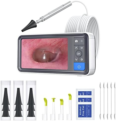 Amazon.com: ScopeAround Otoscope Ear Camera with 4.5" IPS Screen and ...