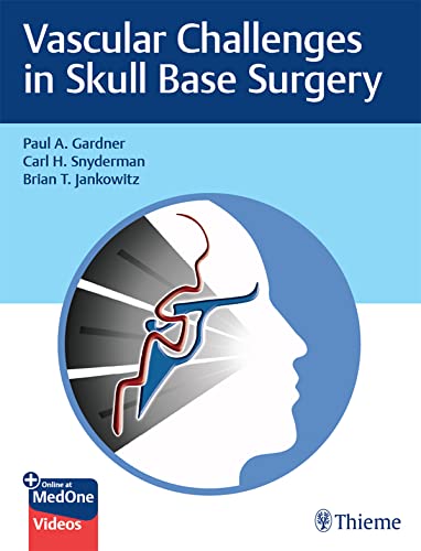Amazon.com: Vascular Challenges in Skull Base Surgery eBook : Gardner ...