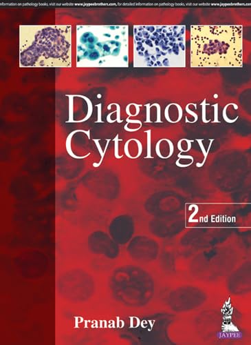 Diagnostic Cytology: 9789352701209: Medicine & Health Science Books ...