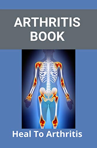 Arthritis Book: Heal To Arthritis: Rheumatoid Arthritis Treatment eBook ...