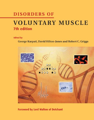 Disorders of Voluntary Muscle: 9780521650625: Medicine & Health Science ...