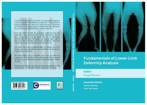 Fundamentals of Lower-Limb Deformity Analysis : Monsell, Fergal: Amazon ...