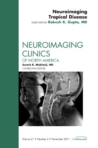 Neuroimaging Tropical Disease, An Issue of Neuroimaging Clinics (Volume ...