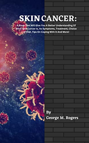 SKIN CANCER: A Book That Will Give You A Better Understanding Of What ...