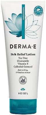 Amazon.com : Derma E Itch Relief Lotion – Anti-Itch for Dry Skin ...