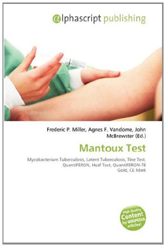 Mantoux Test: Mycobacterium Tuberculosis, Latent Tuberculosis, Tine ...