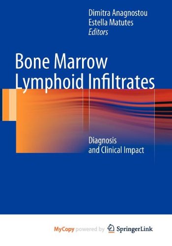 Bone Marrow Lymphoid Infiltrates: Diagnosis and Clinical Impact ...