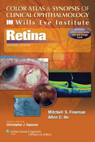 Retina (Color Atlas & Synopsis of Clinical Ophthalmology ...