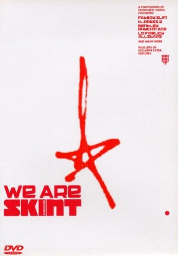 Amazon.com: We Are Skint : Movies & TV