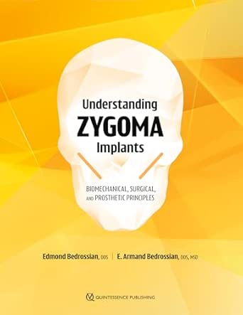 Understanding Zygoma Implants: Biomechanical, Surgical, and Prosthetic ...