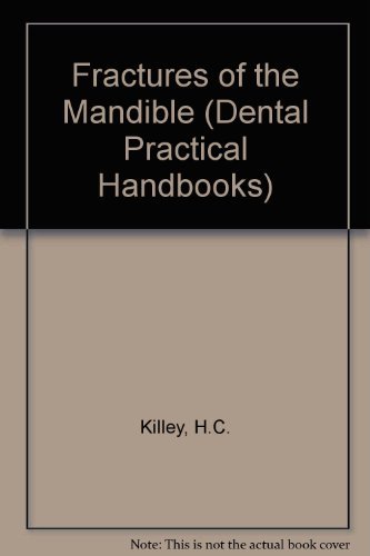 Buy Fractures of the Mandible (Dental Practical Handbooks) Book Online ...
