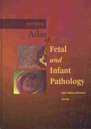 Potter's Atlas of Fetal and Infant Pathology: 9780323001267: Medicine ...