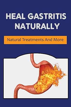 Heal Gastritis Naturally: Natural Treatments And More - Kindle edition by Casale, Frederic ...