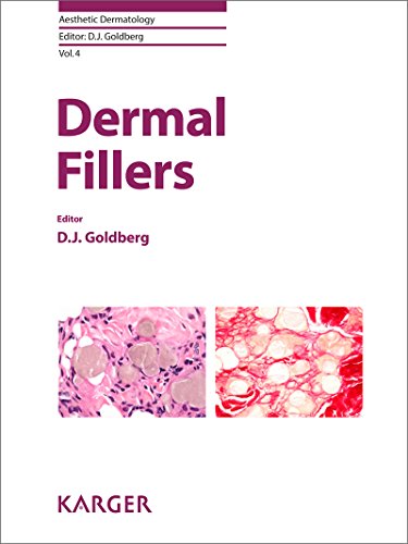 Dermal Fillers (Aesthetic Dermatology Book 4) - Kindle edition by ...
