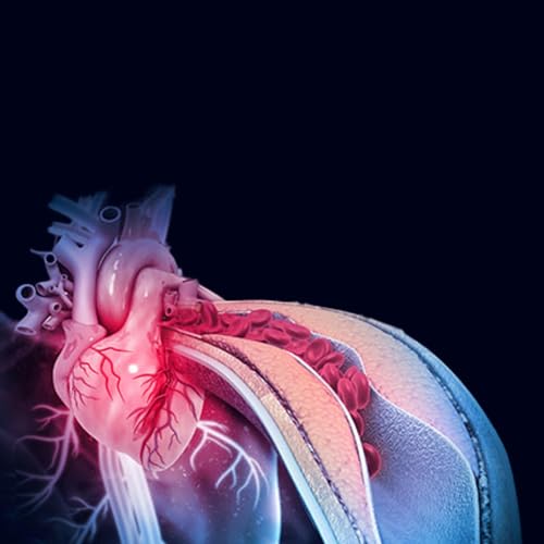 Amazon.com: Understanding Cholesterol Guidelines and Implementing Non ...