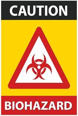 Anne Print Solutions® This Side Up Stickers Pack 6 Pcs Self Adhesive ...