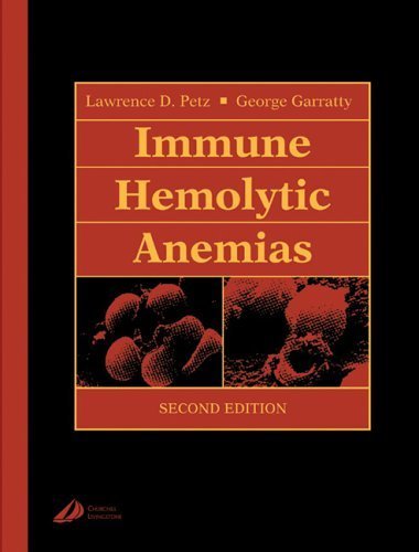 Immune Hemolytic Anemias : Buy Online at Best Price in KSA - Souq is ...