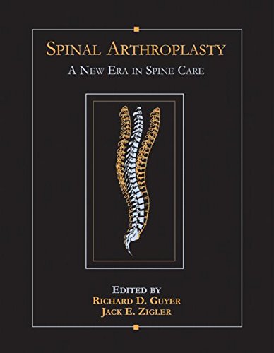 Spinal Arthroplasty: A New Era in Spine Care: 9781576261903: Medicine ...