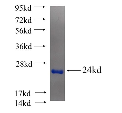 Amazon.com: Human RNF43 Fusion Protein : Industrial & Scientific