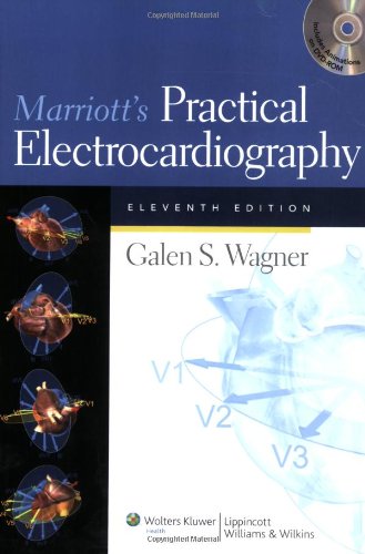 Buy Marriott's Practical Electrocardiography Book Online at Low Prices ...