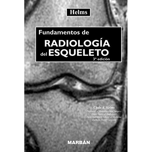 Fundamentos de radiología del esqueleto - 3ª edición : Clyde A. Helms ...