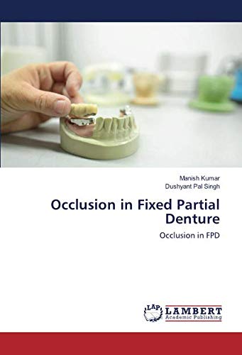 Buy Occlusion in Fixed Partial Denture: Occlusion in FPD Online at ...