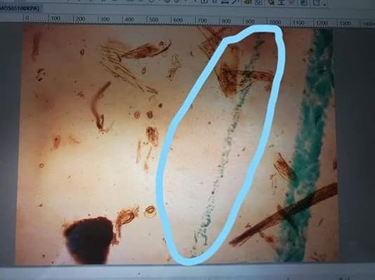 Buy McMaster Method Microscope Slide, FEC (Fecal Egg Count) or Worm ...