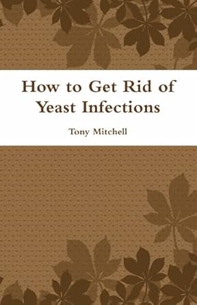How to Get Rid of Yeast Infections: Tony Mitchell: Amazon.com: Books