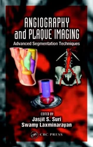 Angiography and Plaque Imaging: Advanced Segmentation Techniques ...