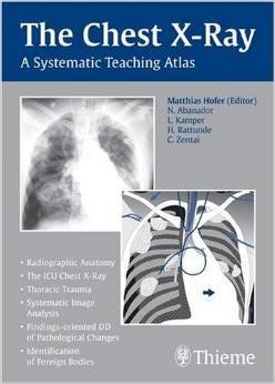 Buy The Chest X-Ray - A Systematic Teaching Atlas Book Online at Low ...
