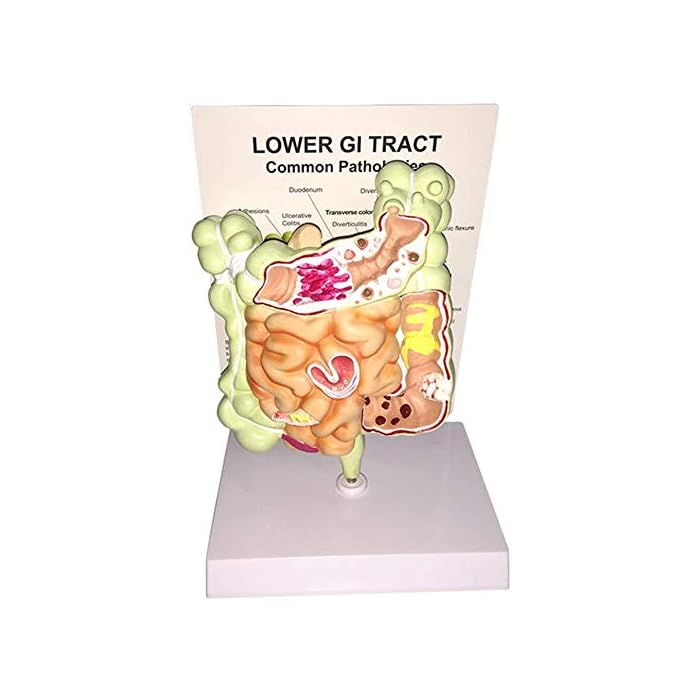 Buy Human Digestive System model - Human Intestine Gut Anatomy ...