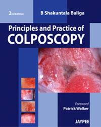 Buy Principles And Practice Of Colposcopy Book Online at Low Prices in ...