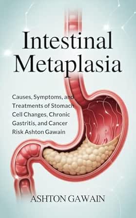 Intestinal Metaplasia : Causes, Symptoms, and Treatments of Stomach ...