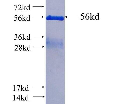 Amazon.com: Human PMM1 Fusion Protein : Industrial & Scientific