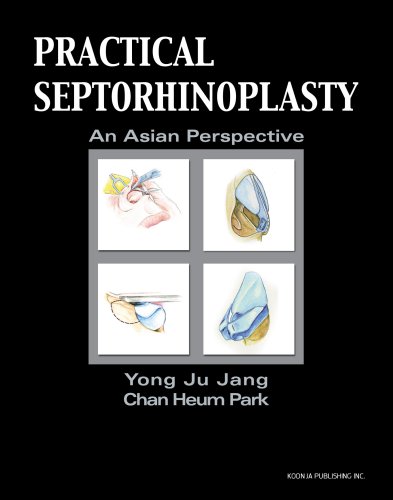 Practical Septorhinoplasty: Yong Ju Jang, Chan Heum Park, Young Ju ...