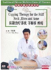 Amazon.com: Cupping Therapy for the Stiff Neck, Hives and Acne : Minji ...