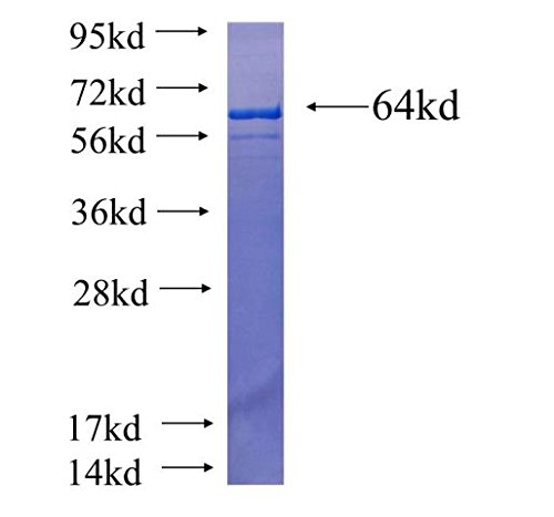 Amazon.com: Human VPS4A Fusion Protein : Industrial & Scientific