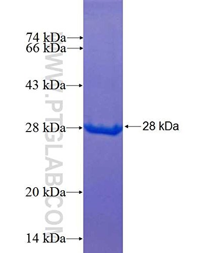 Amazon.com: Null GST Tag Fusion Protein : Industrial & Scientific